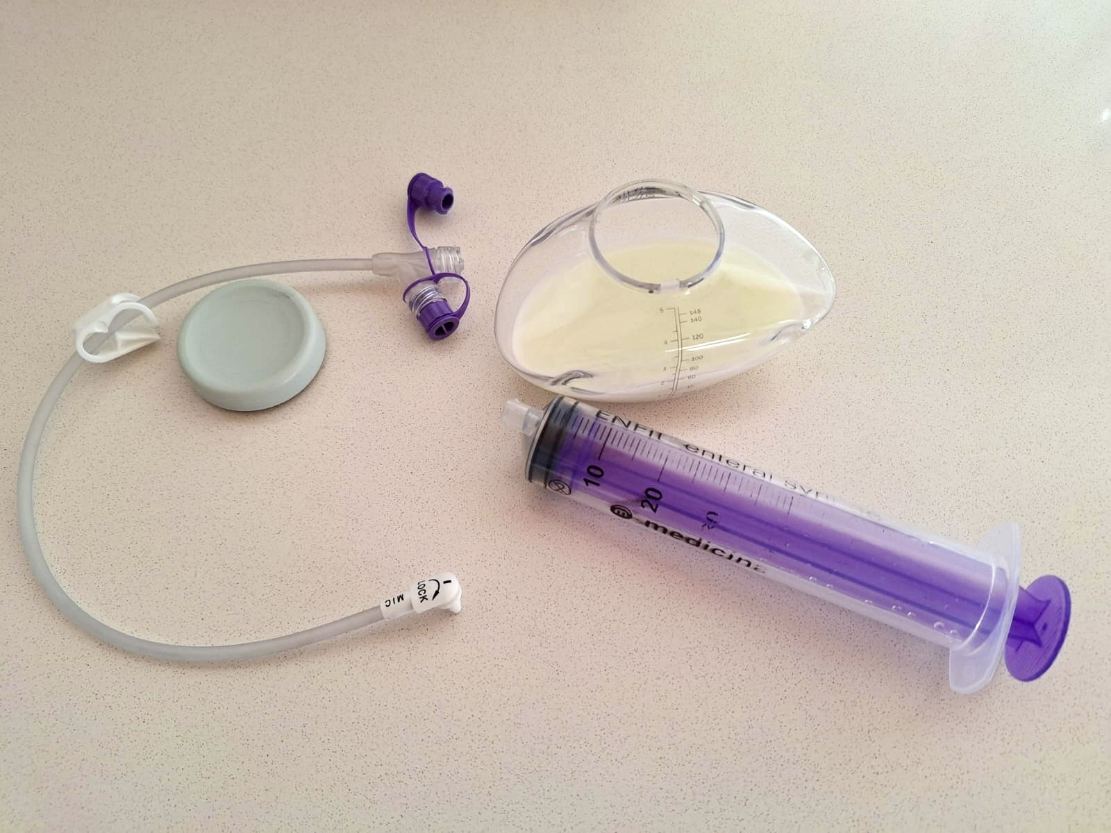 Lactancia materna y gastrostomía, sí es posible. - Spacio Ama