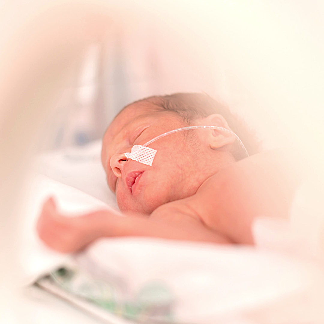 El bebé prematuro - Spacio Ama